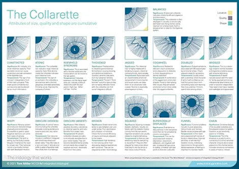 Bowel Reflex and Collarette Chart - Integrated Iridology – Simplee Natural